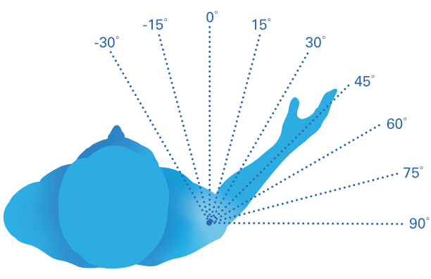 Shoulder Arthroplasty Smart Score