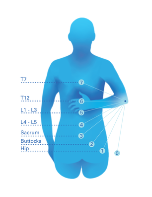 Shoulder Arthroplasty Smart Score